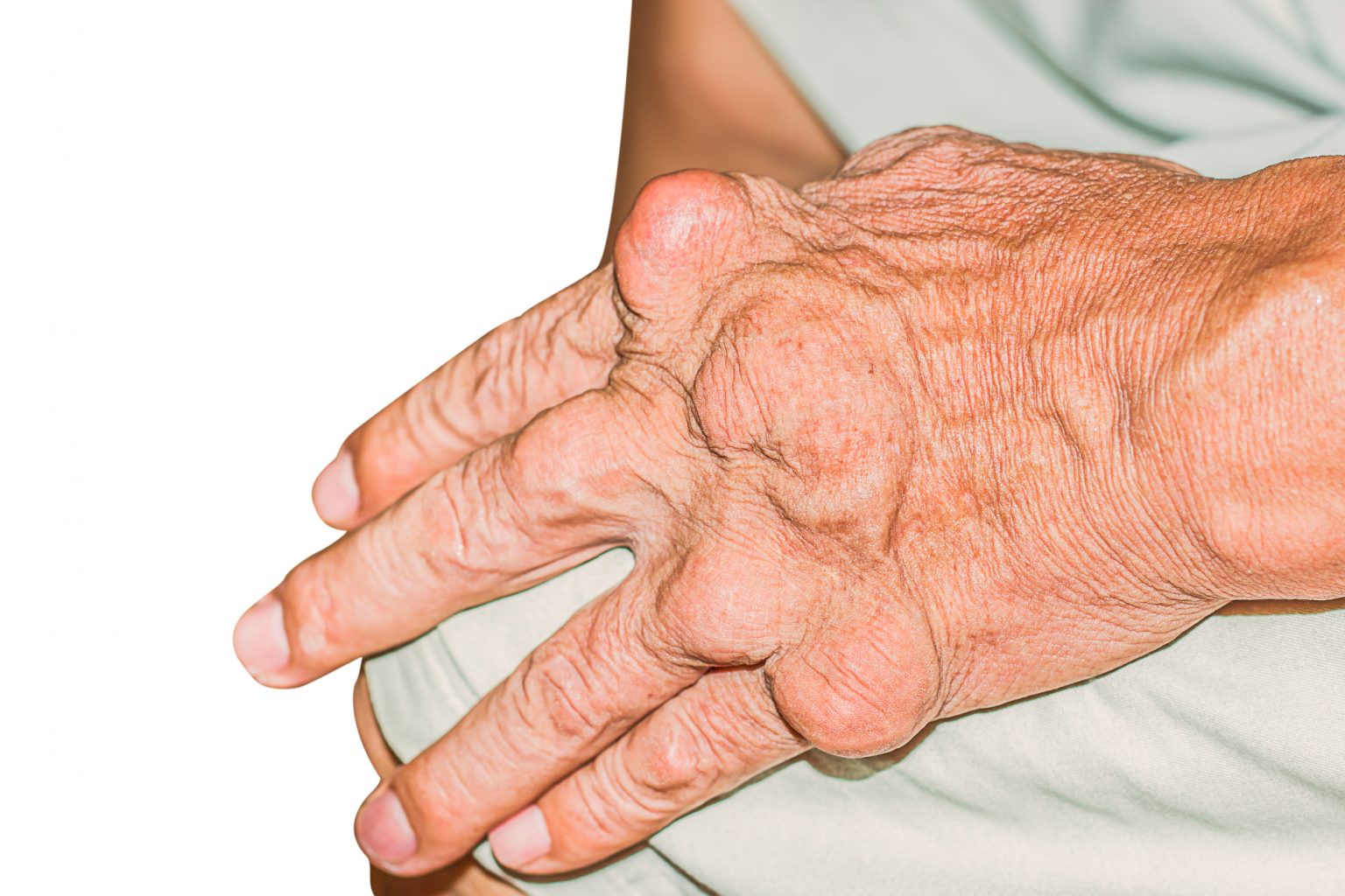 Sosed mi je prvi razložil, kaj je putika